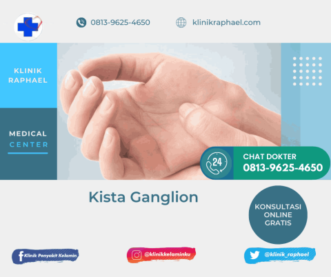 Kista Ganglion Bukan Tumor Ganas, Berikut Faktanya