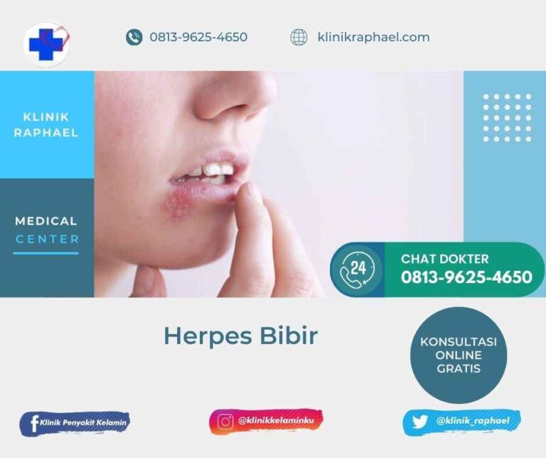 Ciri-Ciri Herpes pada Bibir atau Mulut - Klinik Andrologi